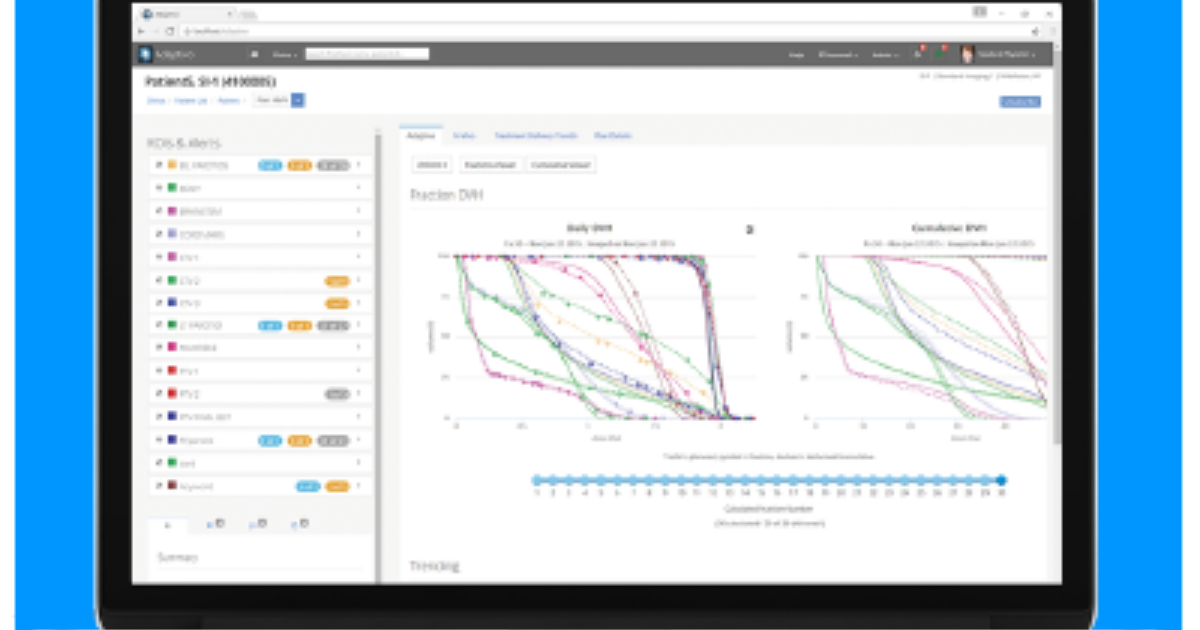 Optimizing Patient Qa Workflow Best Practices And… Standard Imaging