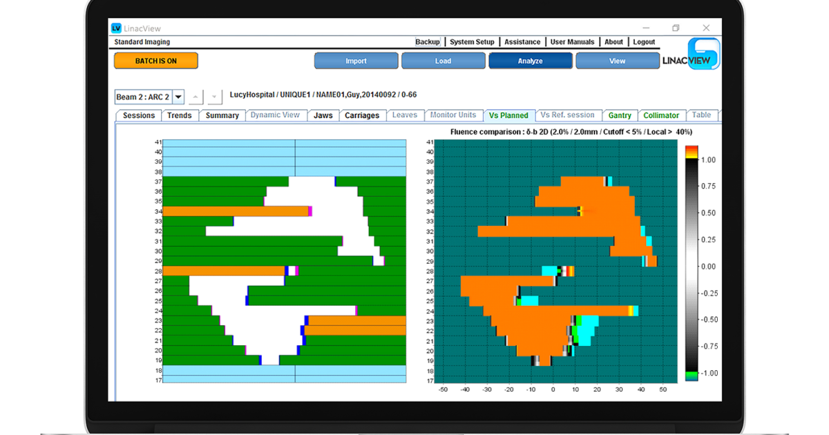 LinacView™ | Standard Imaging